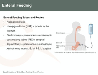 Module 4.1 Enteral Feeding | PPT