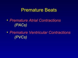 Premature Atrial Contraction Vs Premature Ventricular Contraction