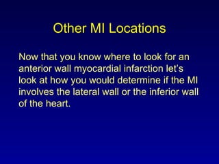 ECG Infarction | PPT