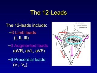 ECG Infarction | PPT