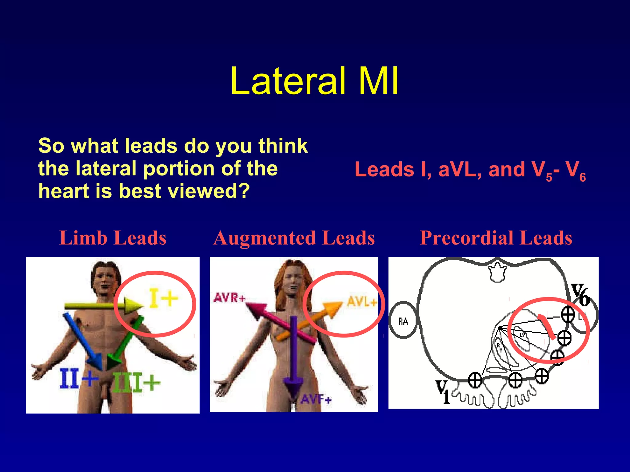 ECG PART 7 | PPT