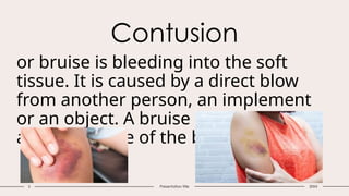 Module 5 - Physical Education 11 .pptx