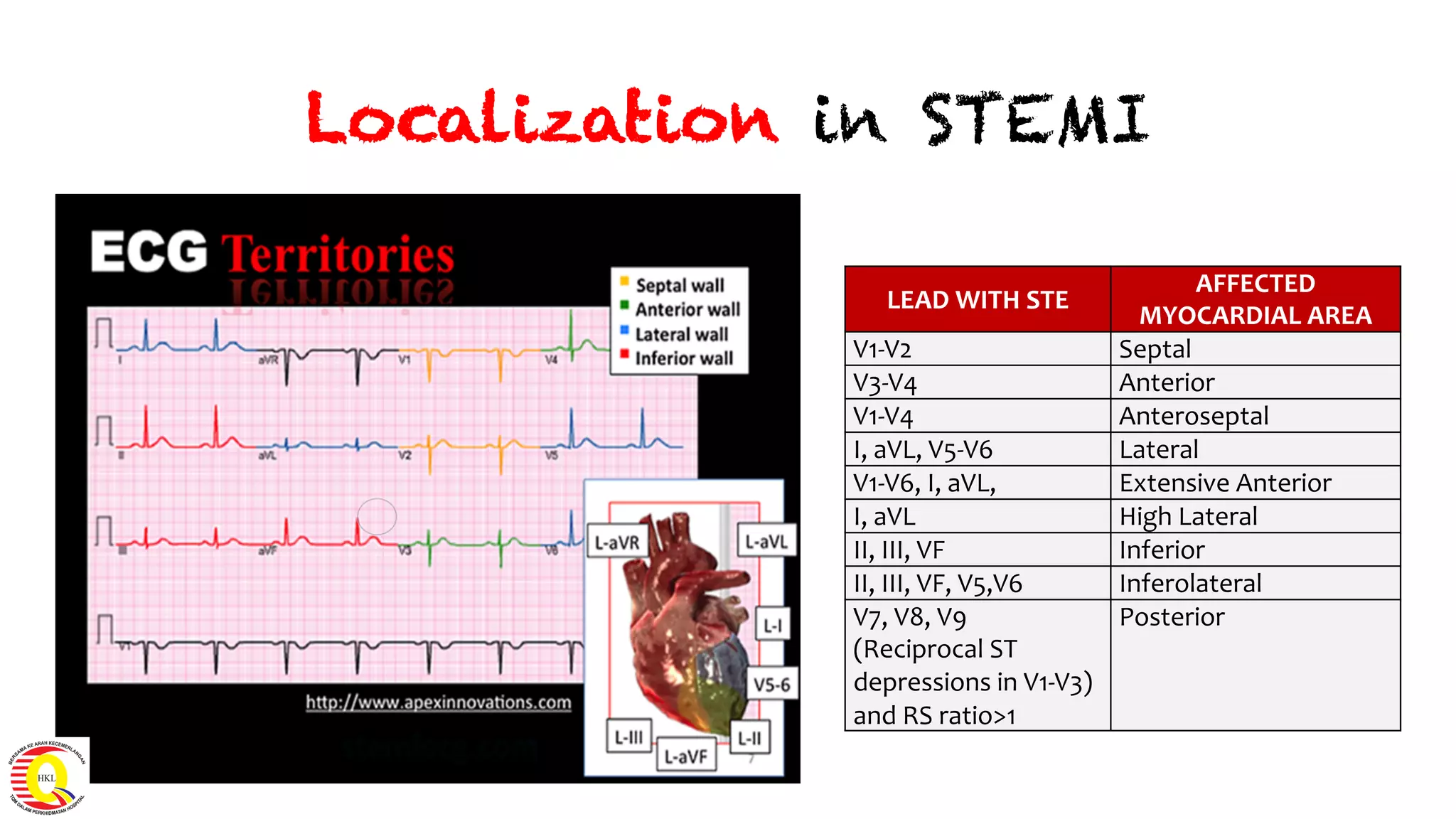 Module 5 tips and tricks- stemi ecg recognition & patterns finale | PPT