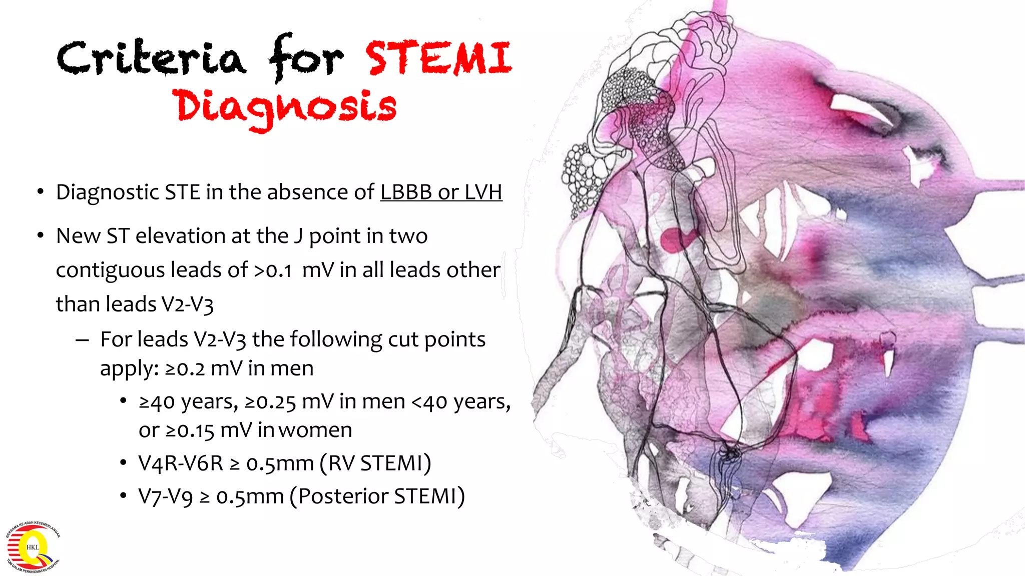 Module 5 tips and tricks- stemi ecg recognition & patterns finale | PDF