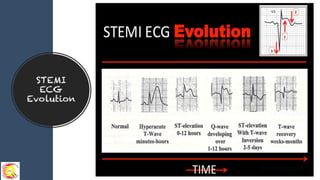 Module 5 tips and tricks- stemi ecg recognition & patterns finale | PDF