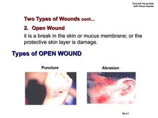 Module 5 first aid Soft Tissue Injury.ppt