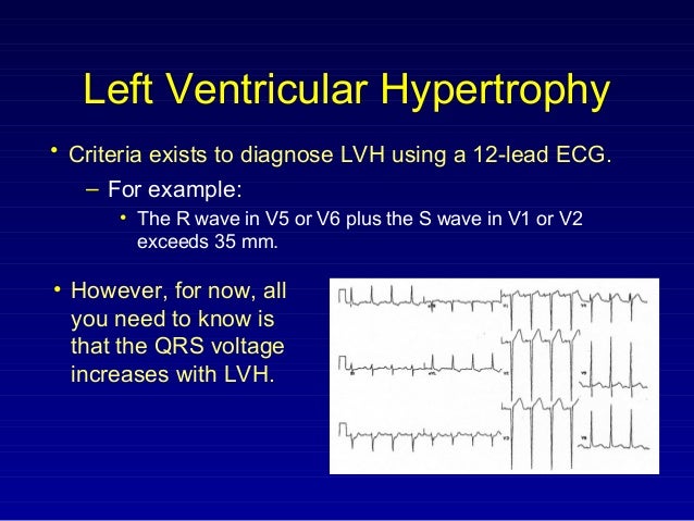 ECG PART 8