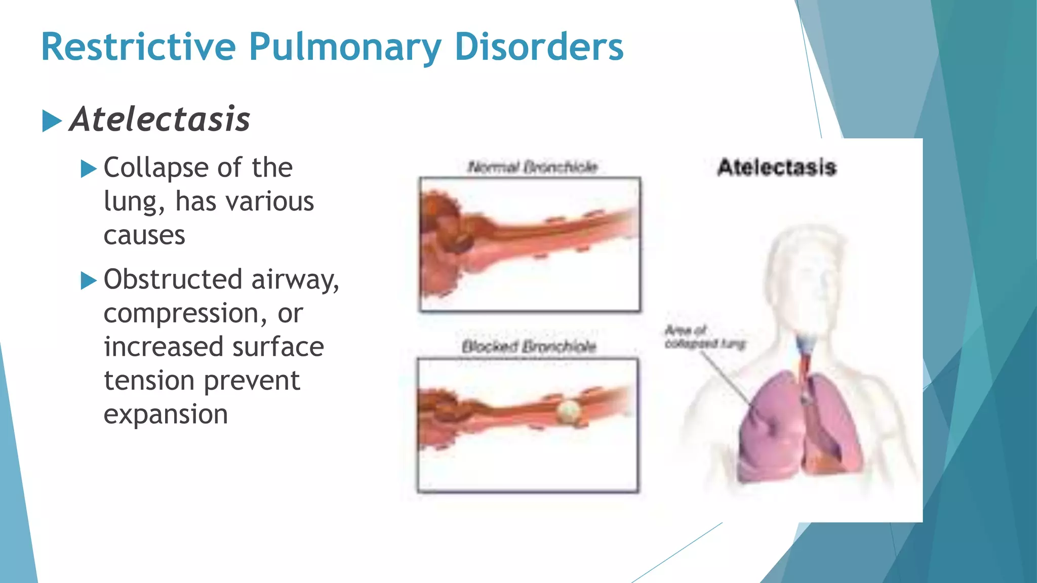 Respiratory Pathophysiology | PPTX