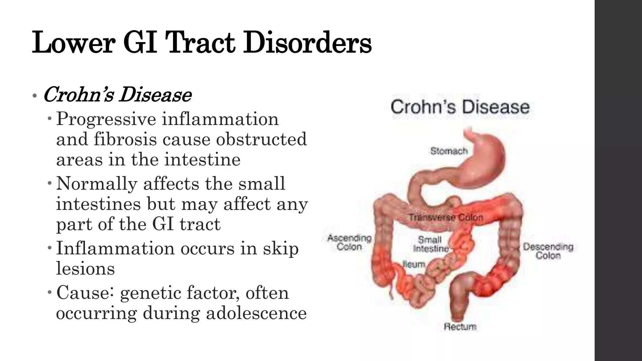 Gastrointestinal Pathophysiology | PPTX