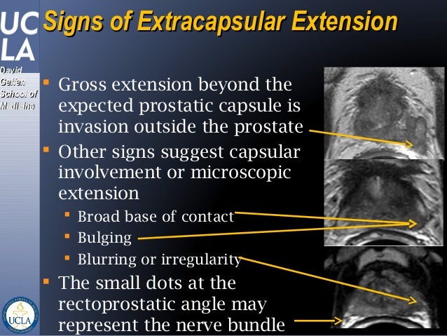 Module 7 Dr Margolis-Mri&Imaging