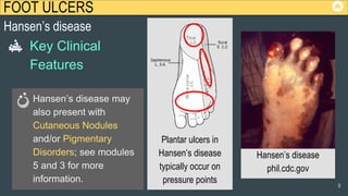 Module_7_Section_1_ULCER. Tropical derm.pdf