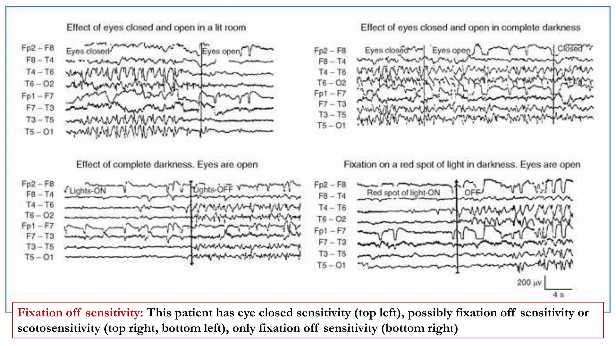 Activation Proceedures in EEG.pptx