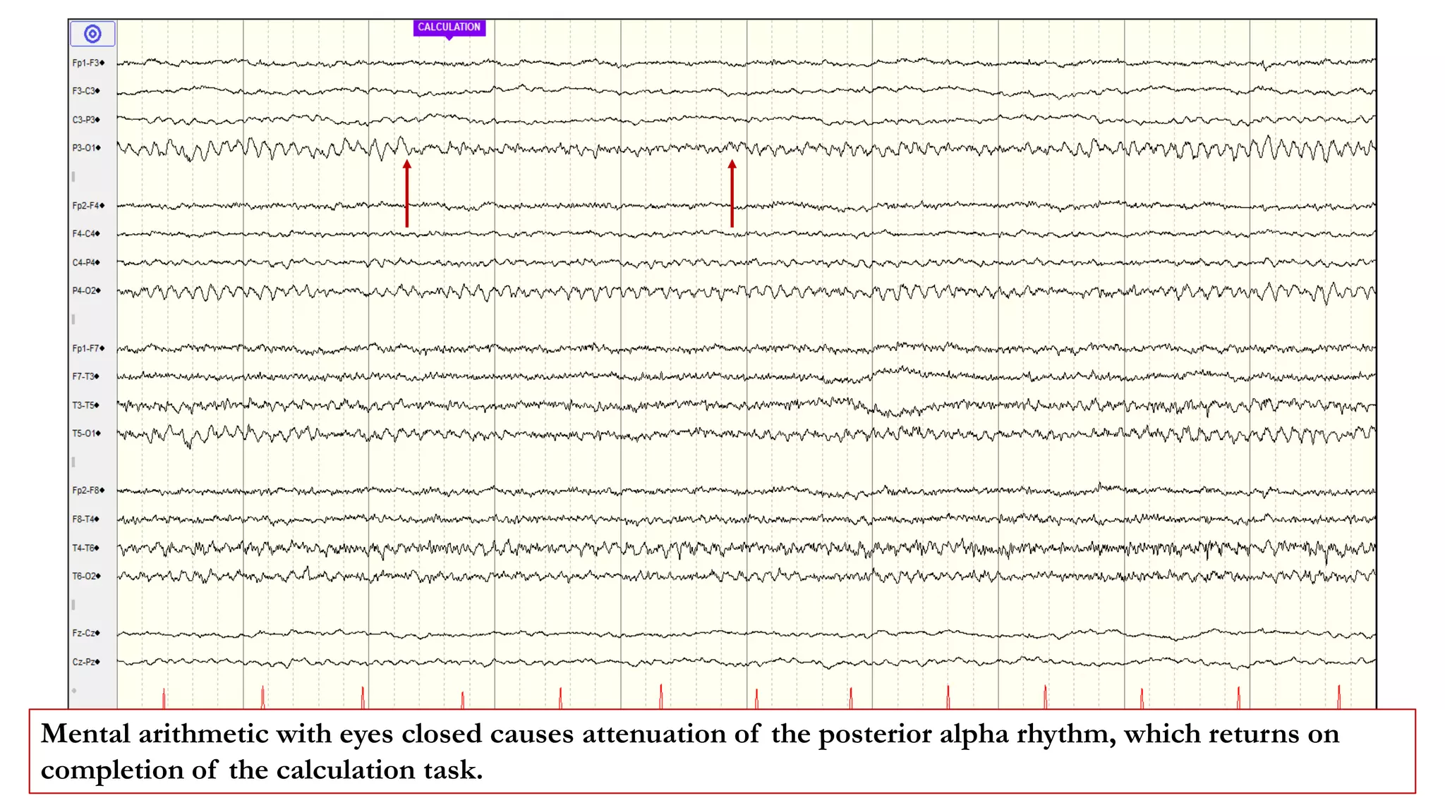 Activation Proceedures in EEG.pptx