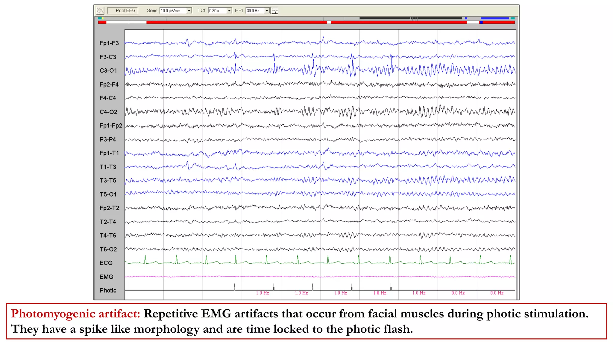 Activation Proceedures in EEG.pptx