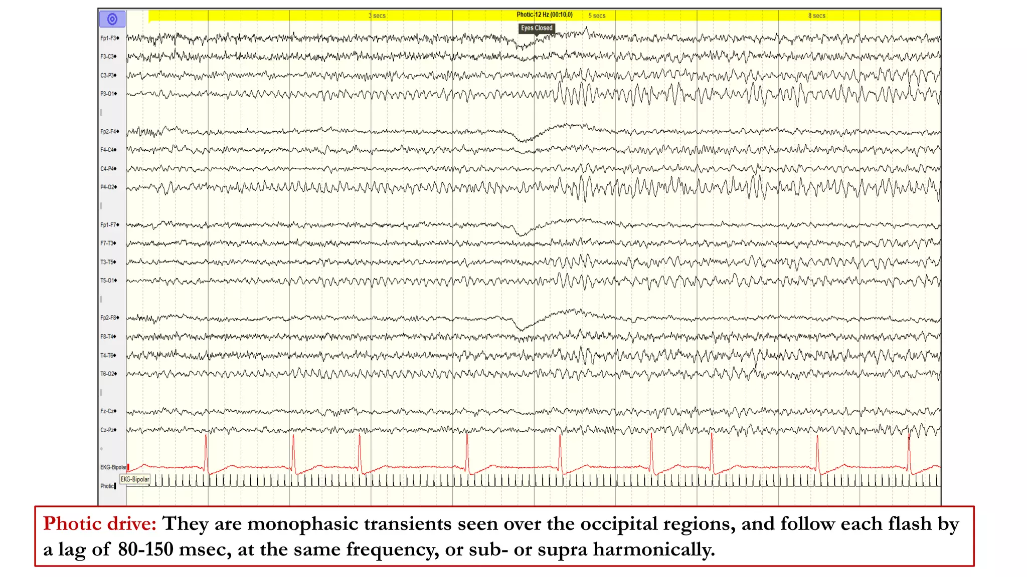 Activation Proceedures in EEG.pptx