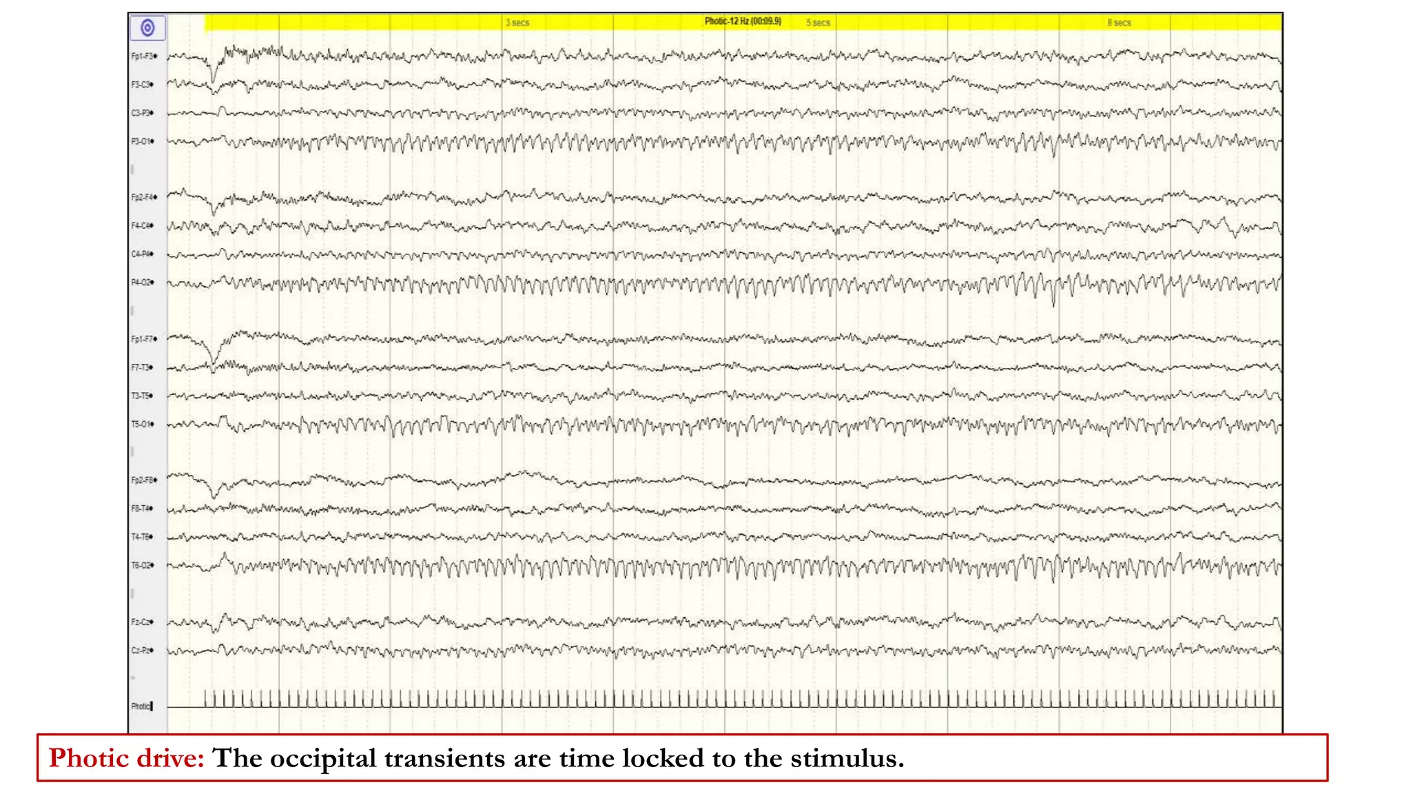 Activation Proceedures in EEG.pptx