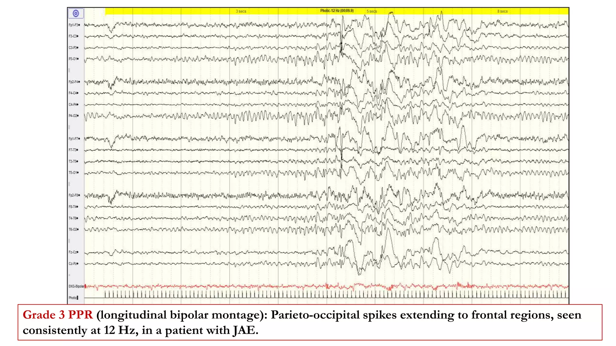 Activation Proceedures in EEG.pptx