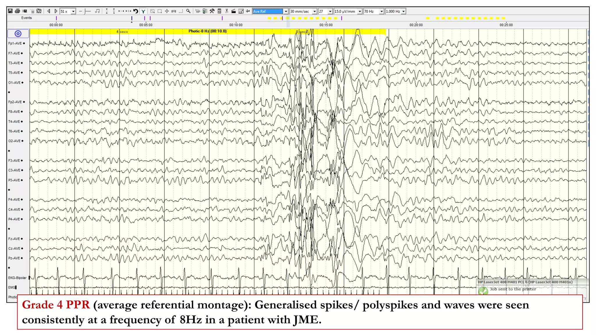 Activation Proceedures in EEG.pptx