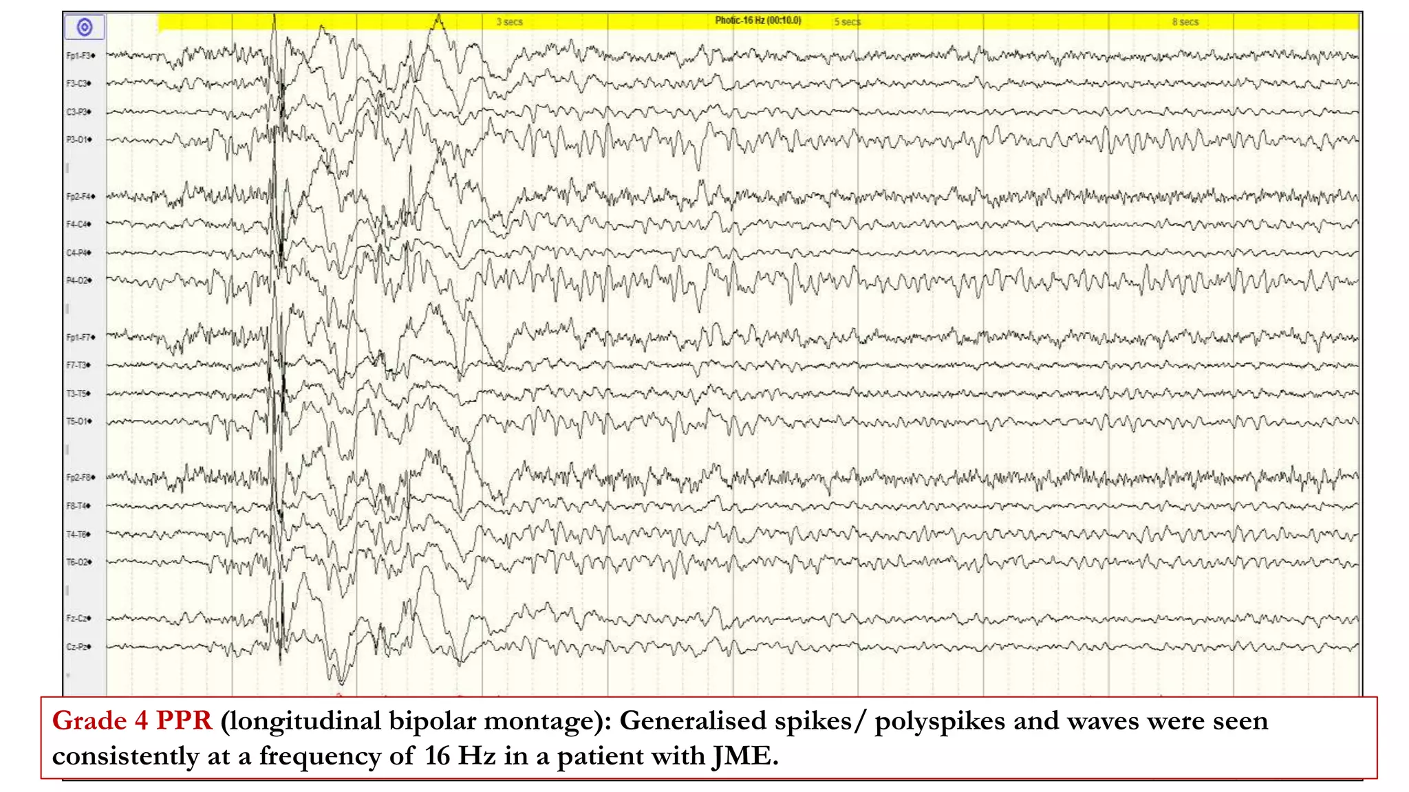 Activation Proceedures in EEG.pptx