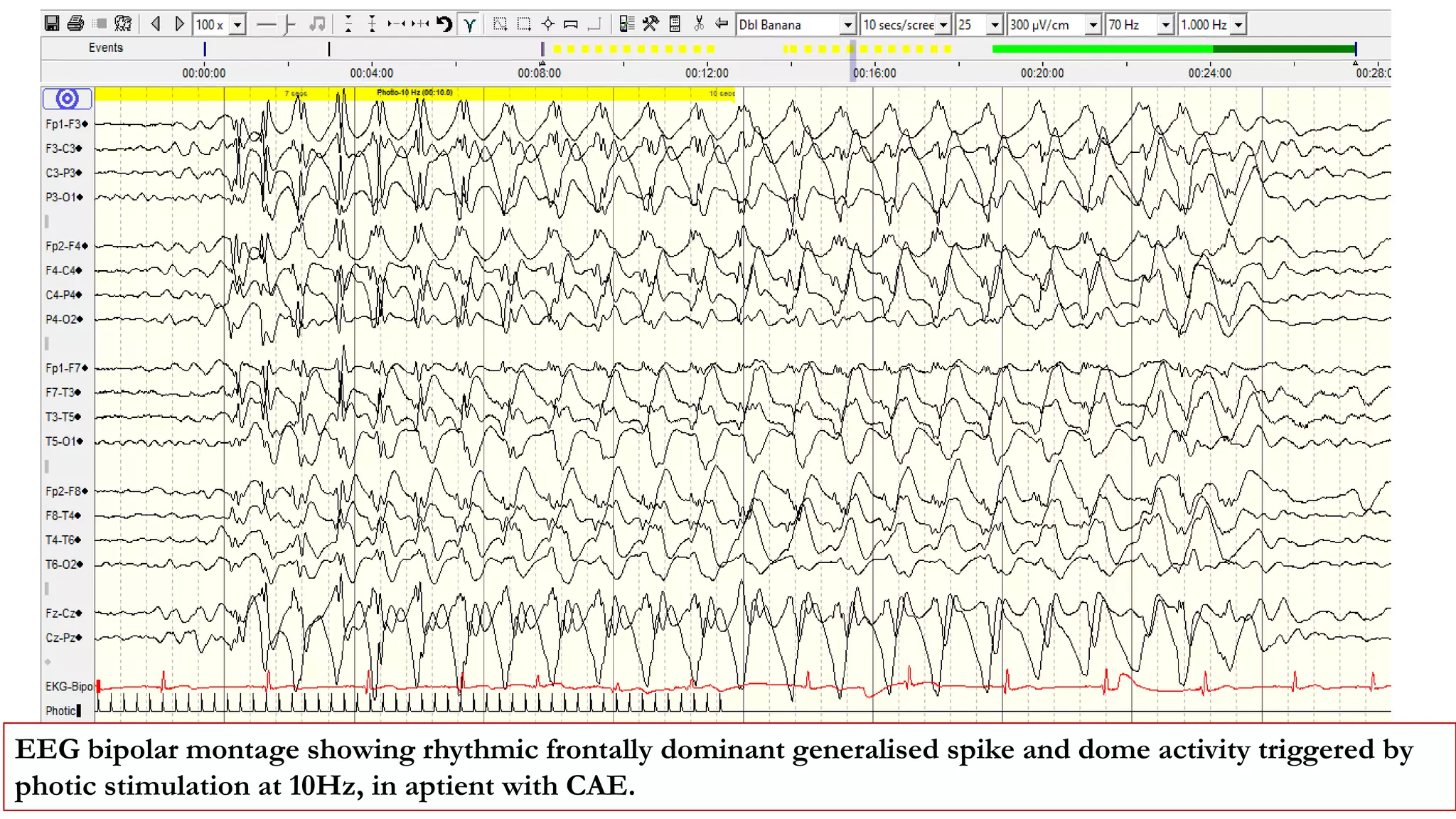 Activation Proceedures in EEG.pptx