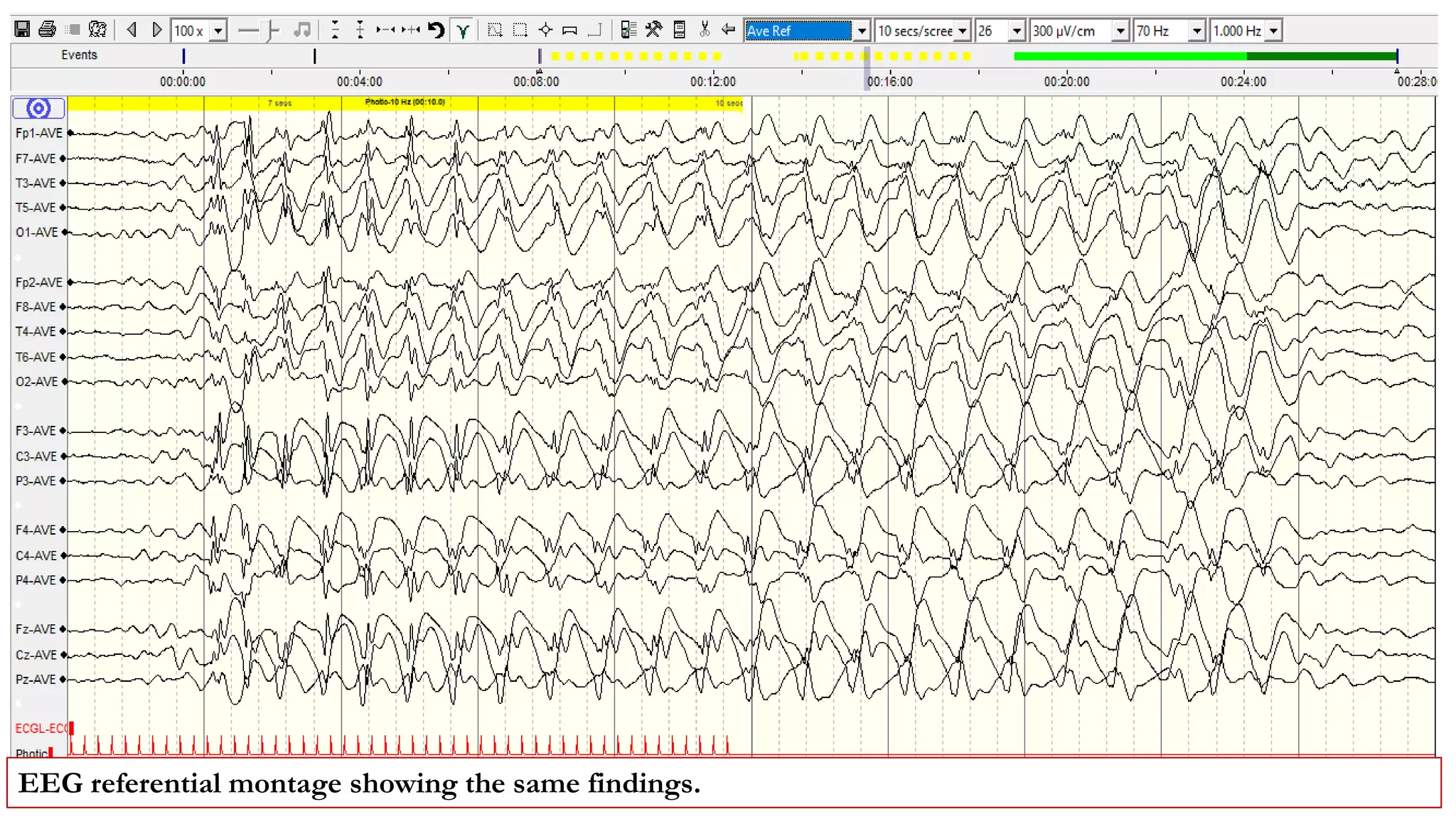 Activation Proceedures in EEG.pptx