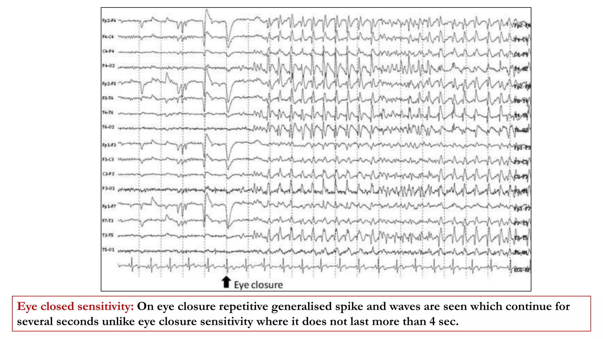 Activation Proceedures in EEG.pptx