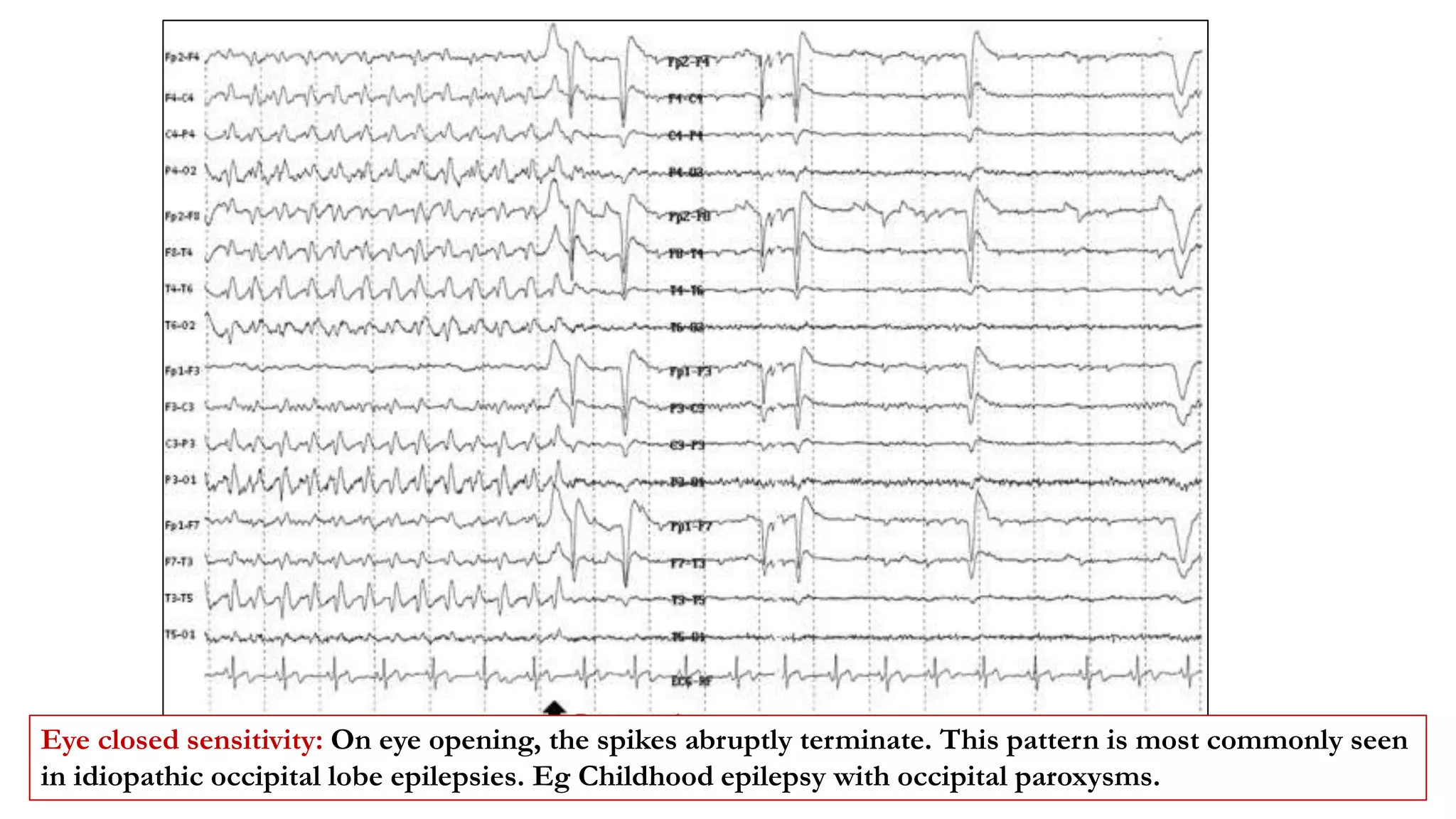 Activation Proceedures in EEG.pptx