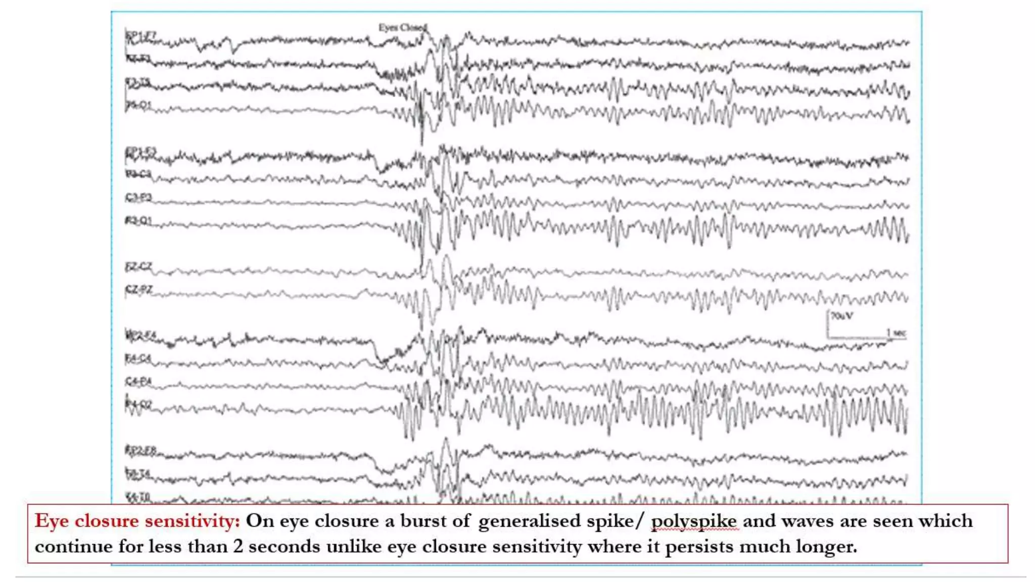 Activation Proceedures in EEG.pptx