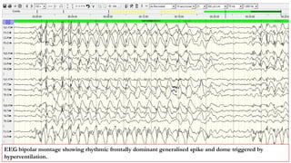Activation Proceedures in EEG.pptx