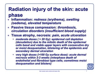 Module III.2.6-Effects of partial body irradiation.ppt