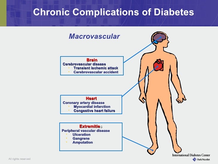 Module iii complications of dm