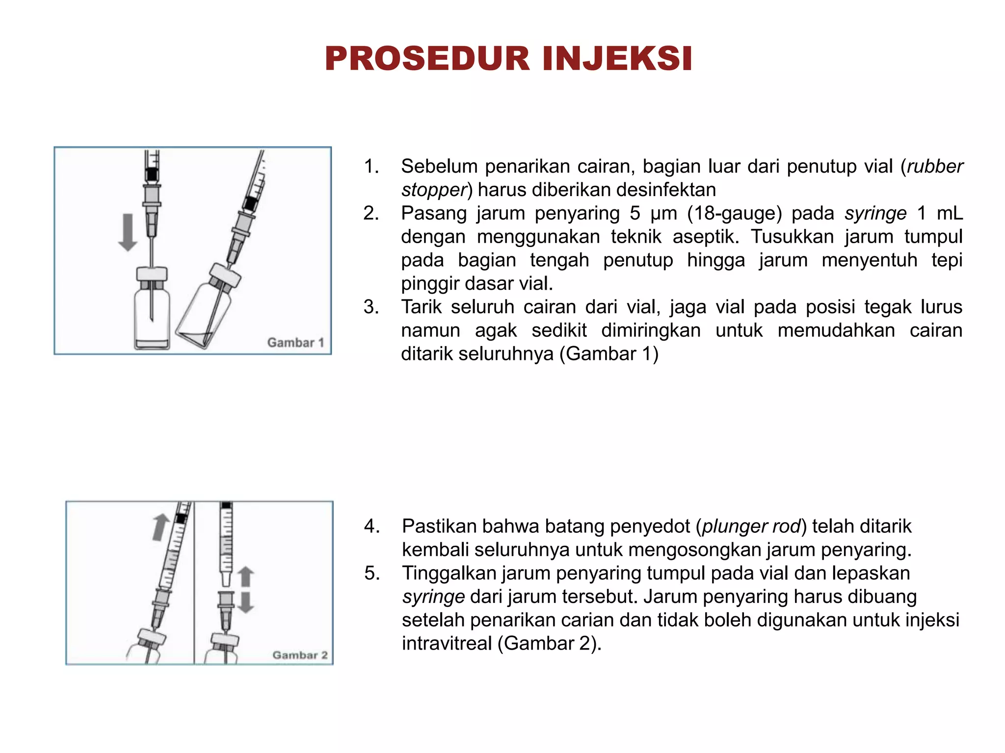 Module injeksi intravitreal.pptx