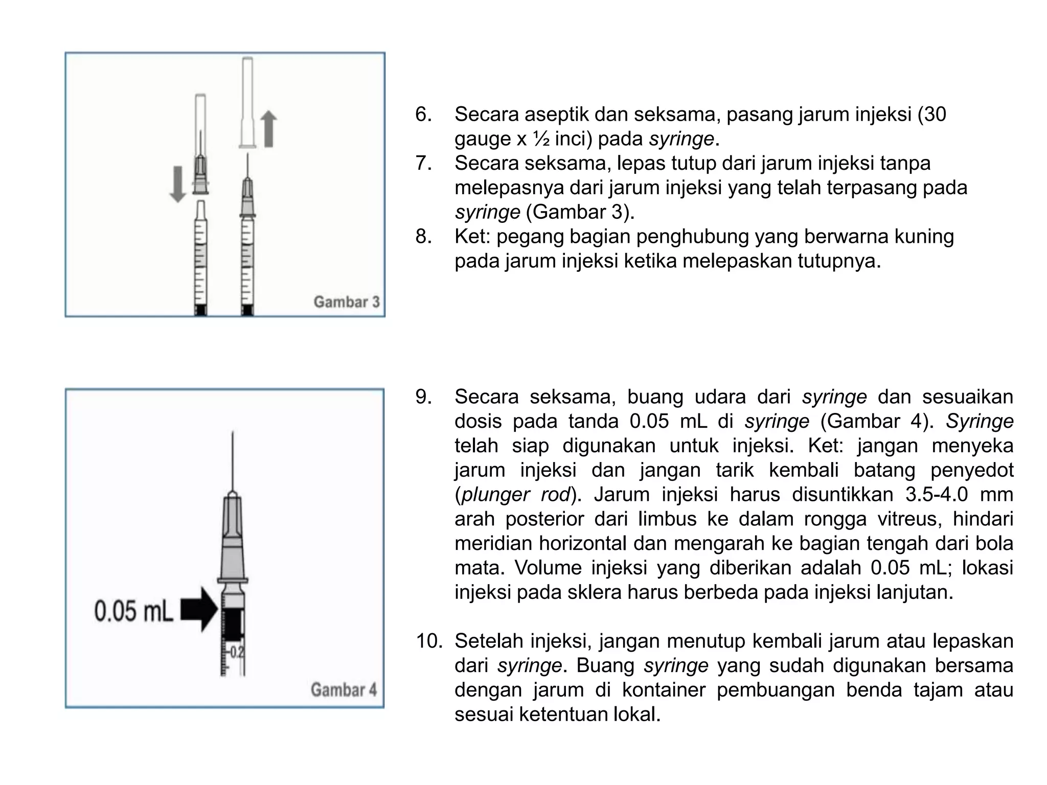 Module injeksi intravitreal.pptx