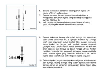 Module injeksi intravitreal.pptx