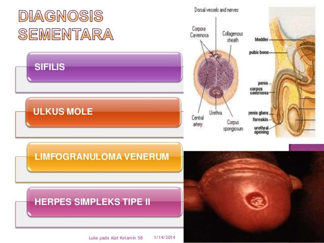 Luka alat kelamin uronefrologi