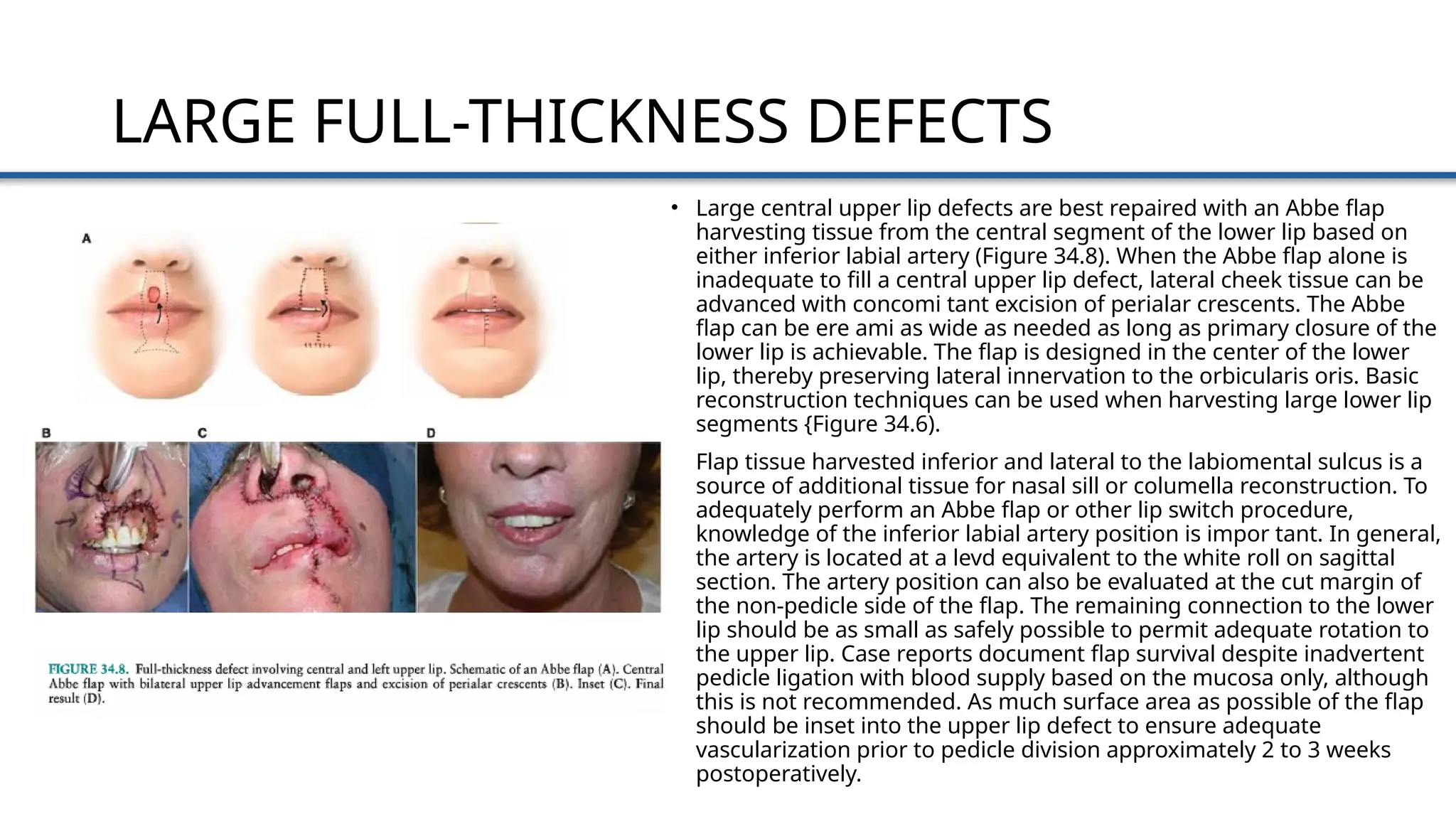 Modul Lip reconstruction LAN.pptxbdiejejenejjenjej | PPTX