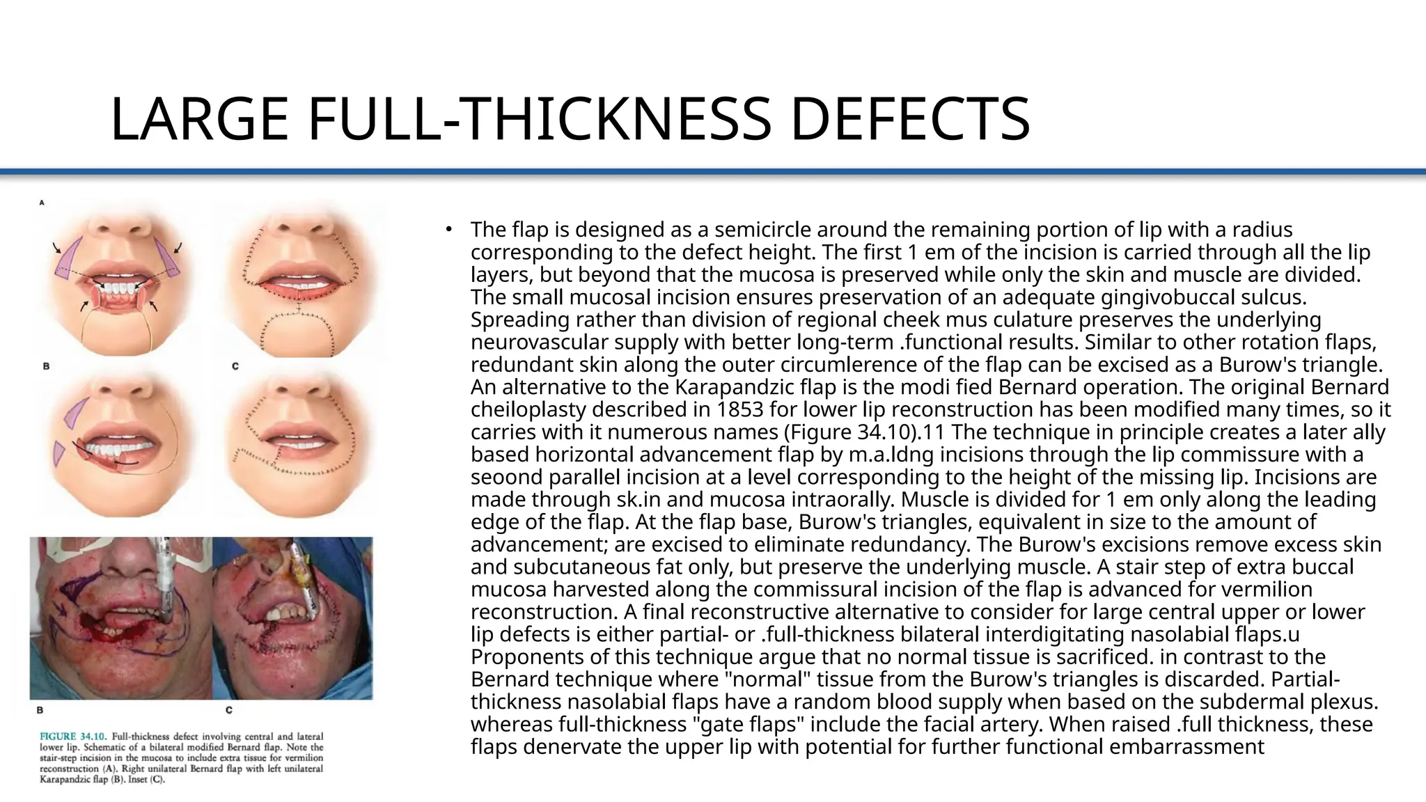 Modul Lip reconstruction LAN.pptxbdiejejenejjenjej | PPTX