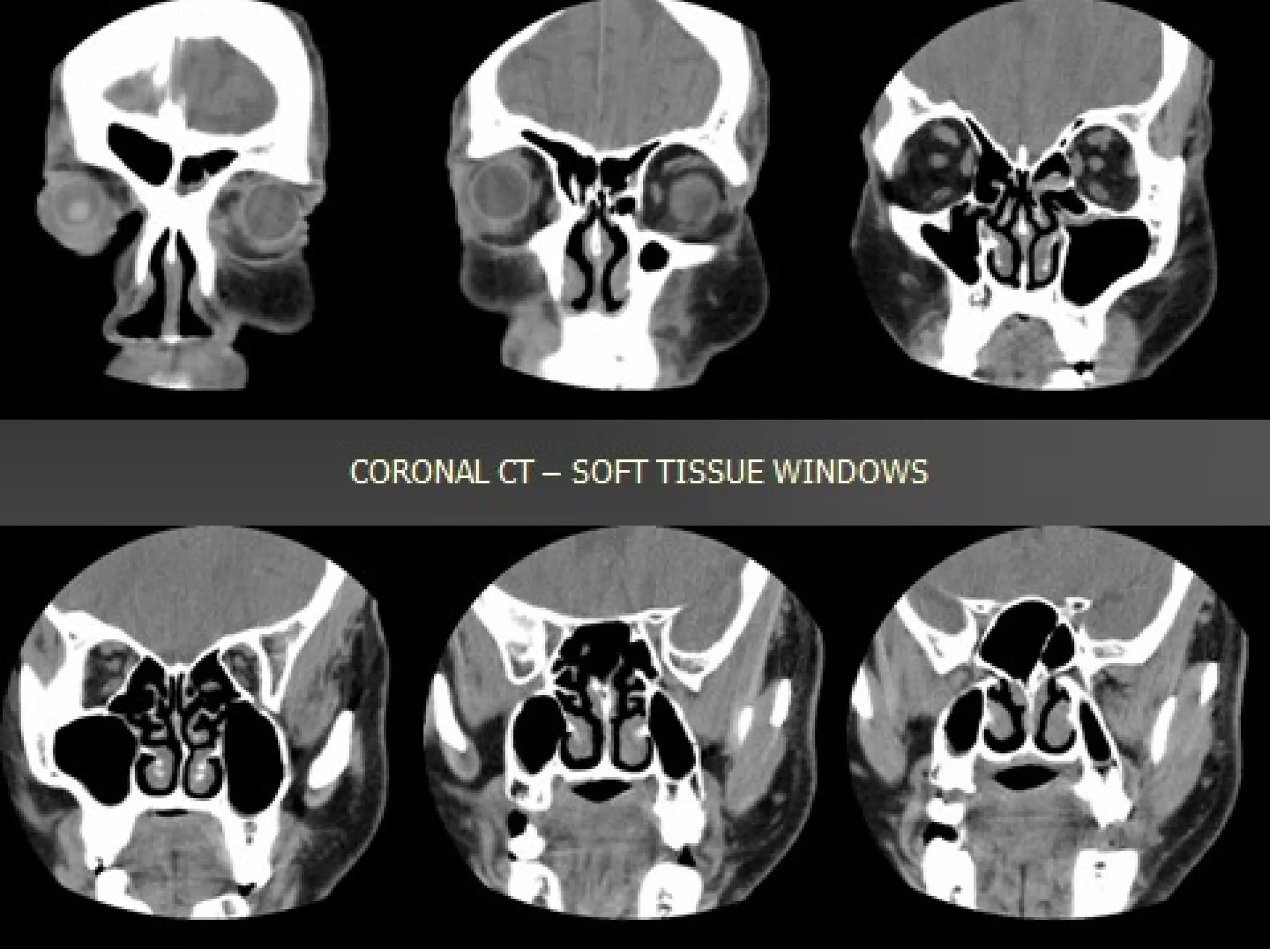 Modul mata radiologi | PPT