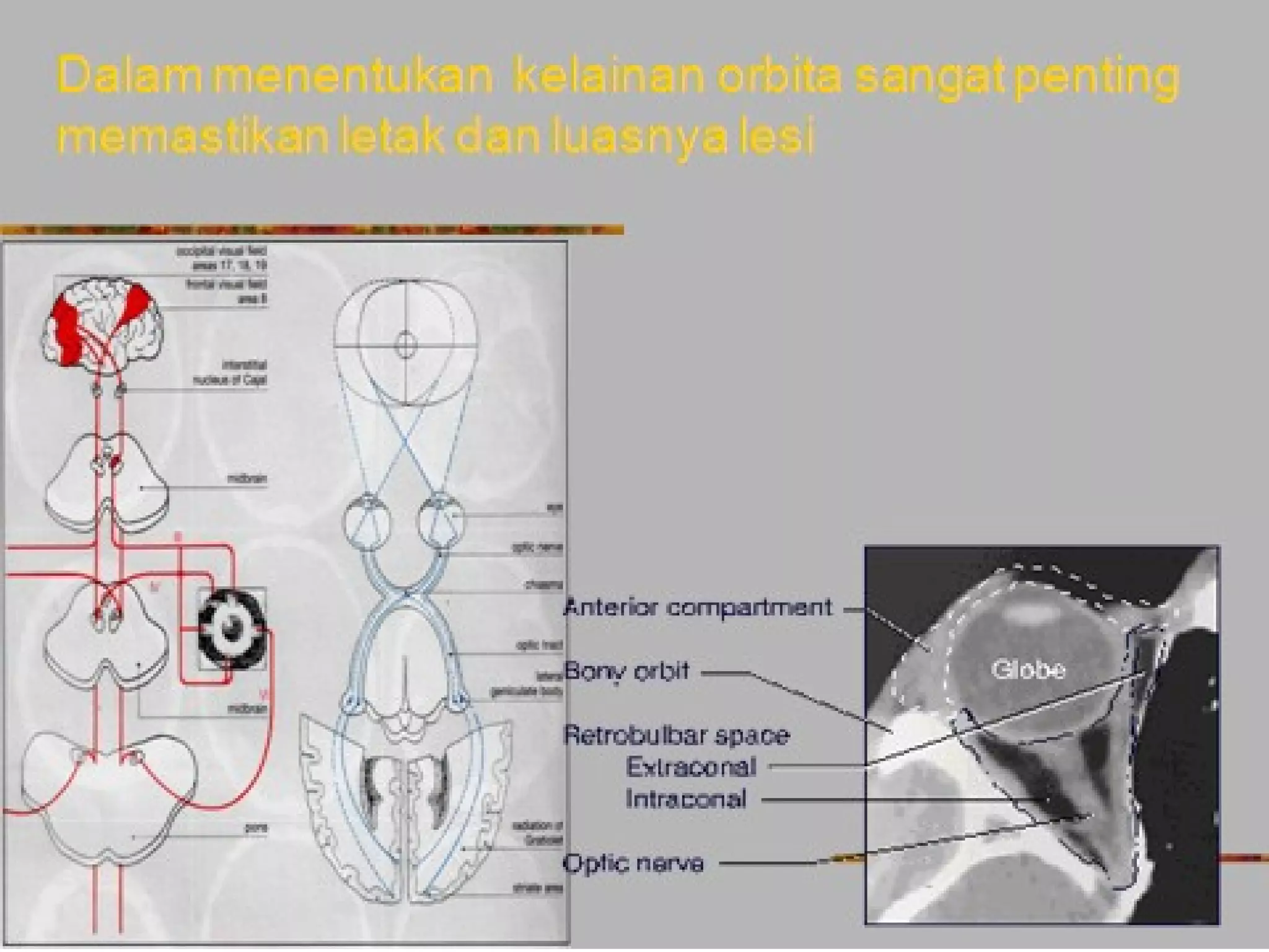 Modul mata radiologi | PPT