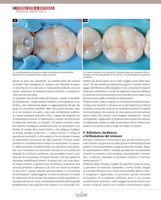 Odontoiatria Adesiva - Primo Modulo | PDF