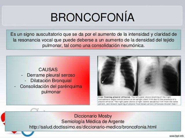 caso cardio-respiratorio