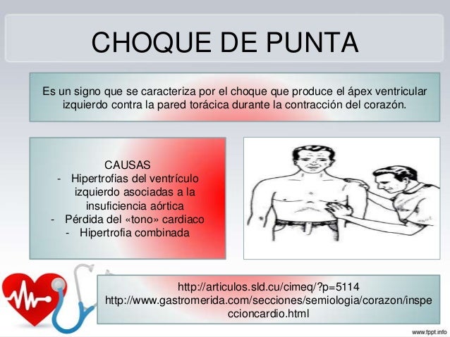 caso cardio-respiratorio
