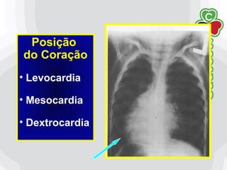 Modulo 2 rx torax | PPT