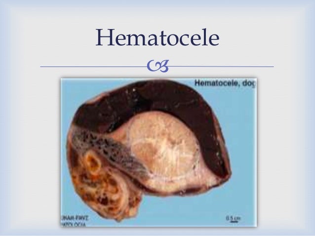 Modulo aparato reproductor_masculino