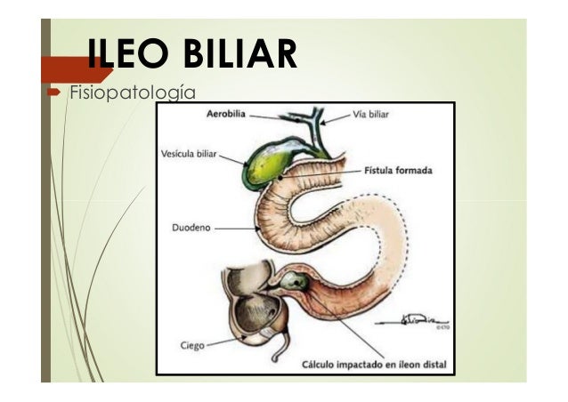 MODULO DE PATOLOGÍA BILIAR
