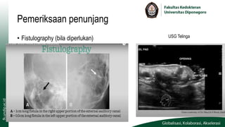 Modul_Otologi_Fistula preauricular_Selasa_20-06-23.pptx