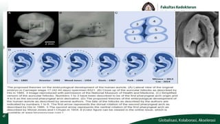 Modul_Otologi_Fistula preauricular_Selasa_20-06-23.pptx