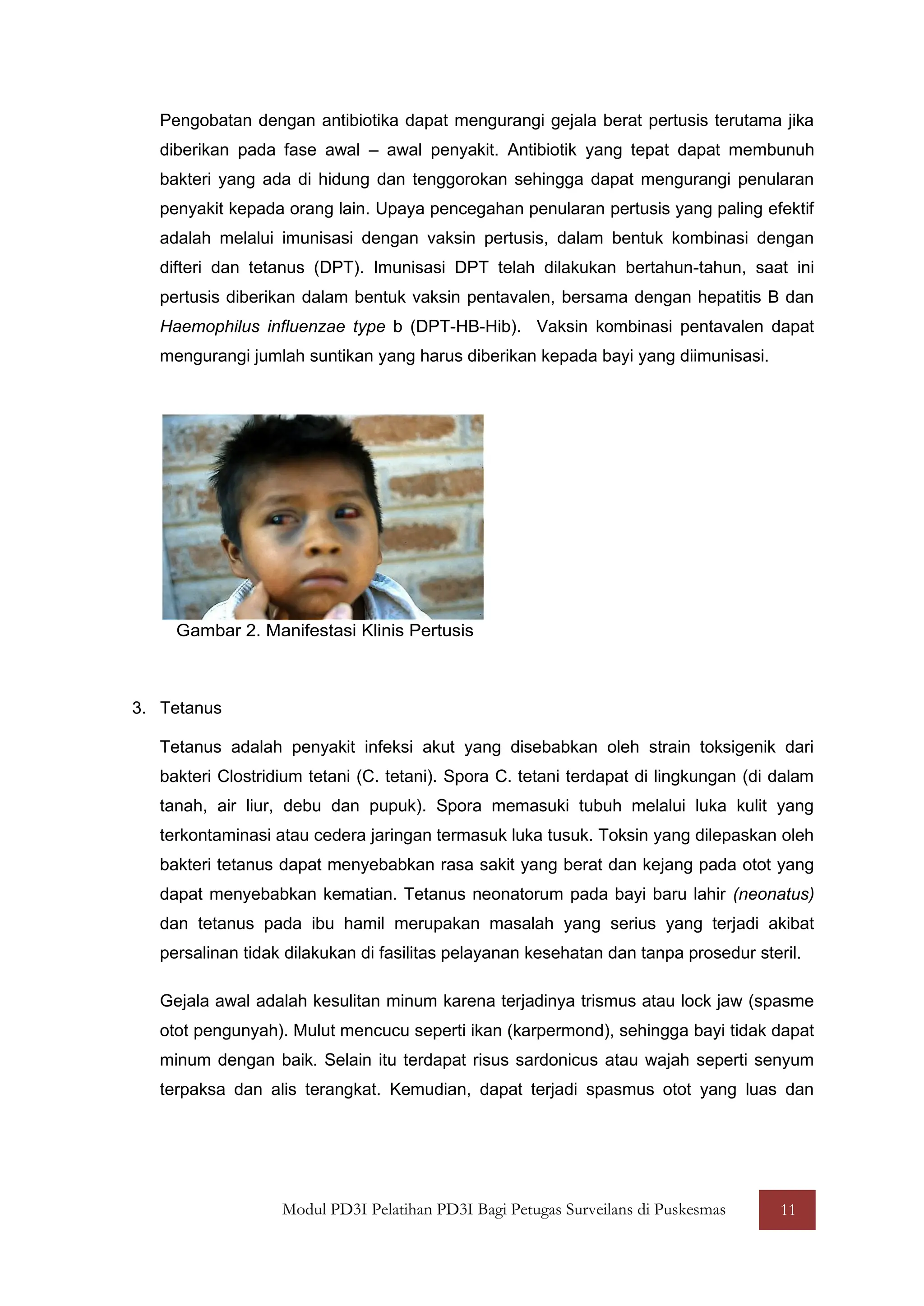 KEBIJAKAN SURVEILANS PENYAKIT YANG BISA DICEGAH DENGAN IMUNISASI (PD3I) | PDF