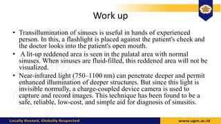 Management Rhinosinusitis in chiIdren.pptx