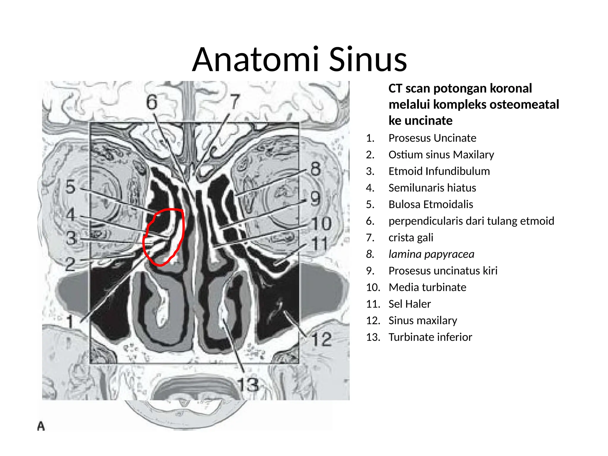 Modul kolegium tht bkl 2015 rhinosinusitis | PPTX